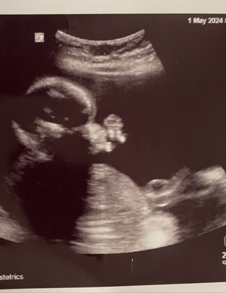 Baby Kade Preston Wilkinson - 2024 - Cannon Funeral Home